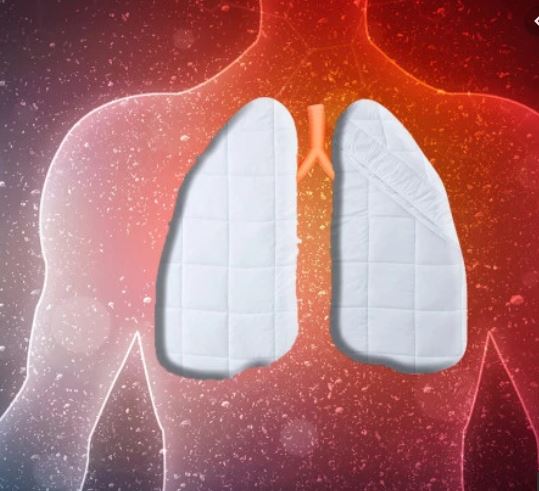 Health: “Feather Duvet Lung” Left Undiagnosed Risks Irreversible Lung ...