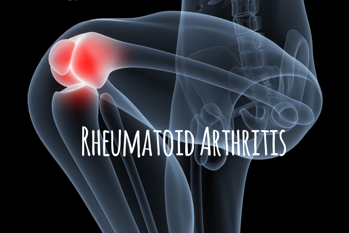Research: Scientists Find Protein To Regulate Immune Attacks, Reduce ...