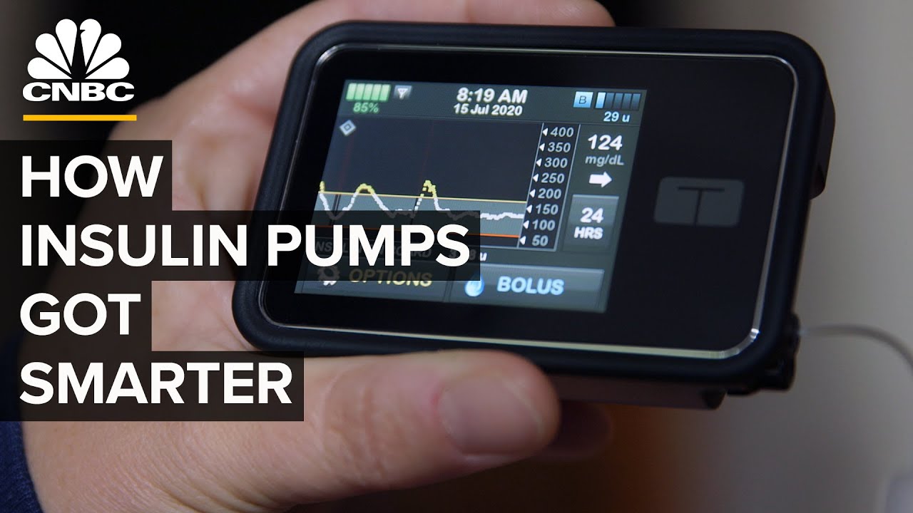 Health Technology Video: “Smart Insulin Pumps” For Diabetes Management ...