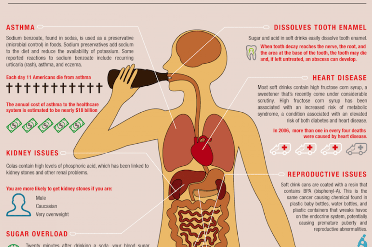 Infographics: Unhealthy Impact Of Drinking Soda | Boomers Daily