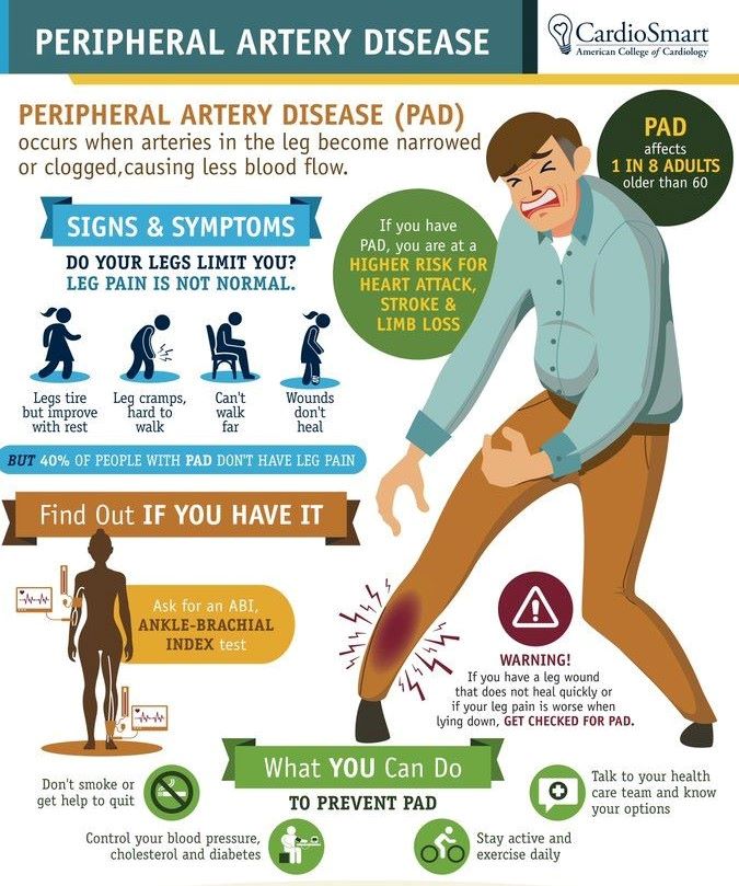 Health Infographics: ‘Peripheral Artery Disease’ | Boomers Daily