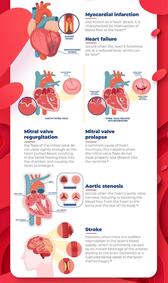Infographic: Types And Causes Of Heart Disease | Boomers Daily
