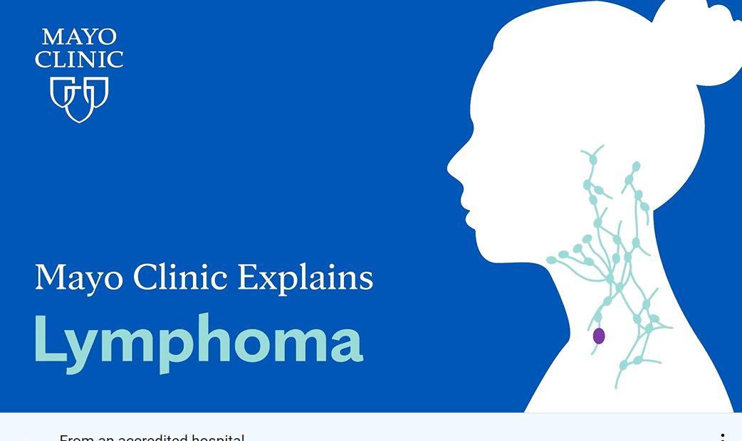 Medicine: The Mayo Clinic Explains Lymphoma (Video) | Boomers Daily